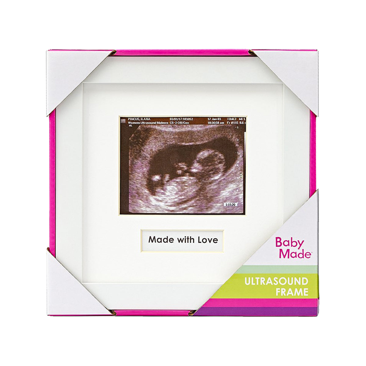 Pregnancy Ultrasound Frame